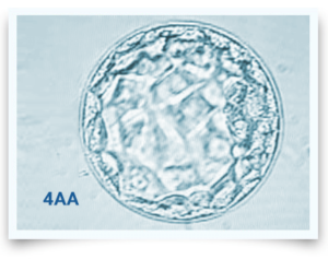 Embryo Grading and Success Rates - SENSIBLE Surrogacy Agency